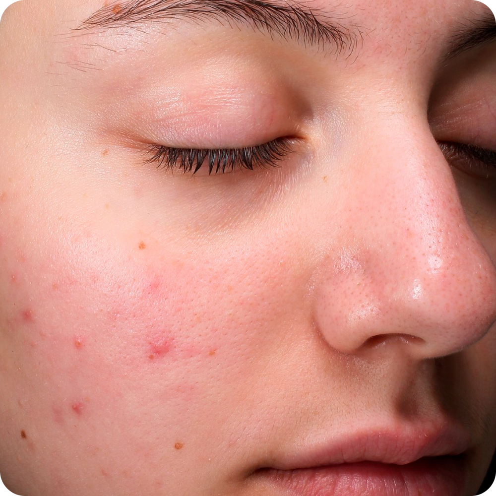Our Technology | Biotech-Driven Mineral SPF by SunsolveMD